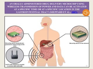 Microchip for cdds | PPTX