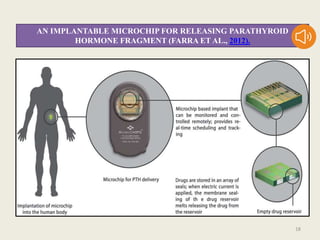 Microchip for cdds | PPTX