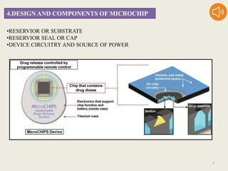 Microchip for cdds | PPTX