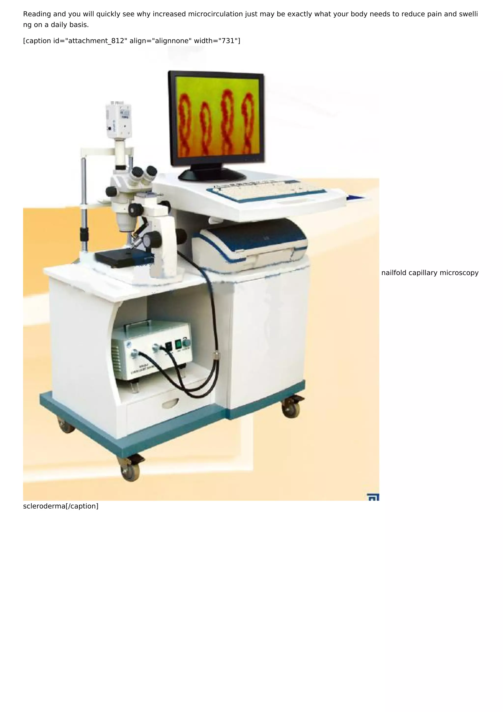 Microcirculation microscope and its parts is what | PDF