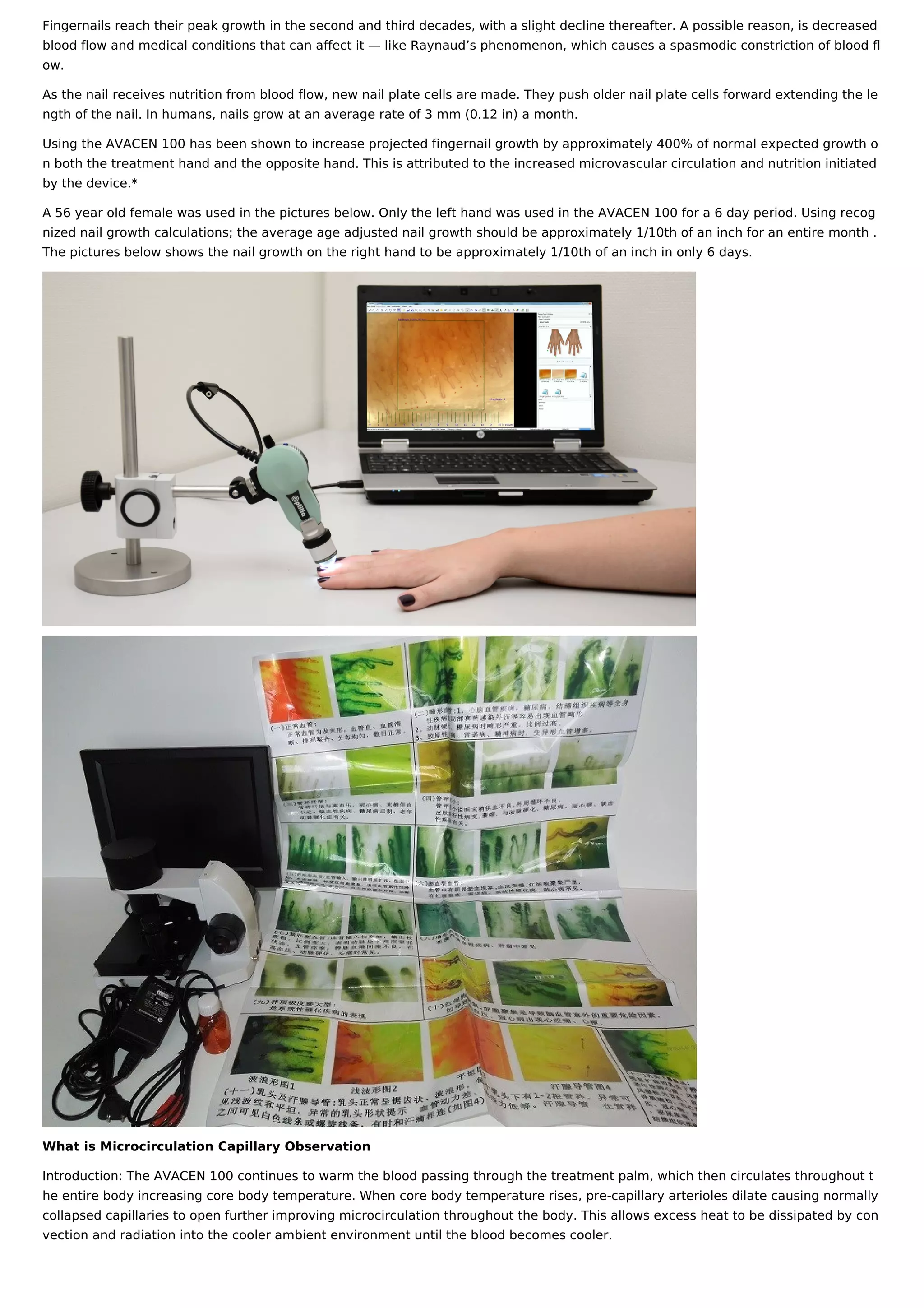 Microcirculation microscope and its parts is what | PDF