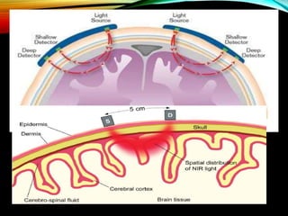 Microcirculation vs macrocirculation | PPTX