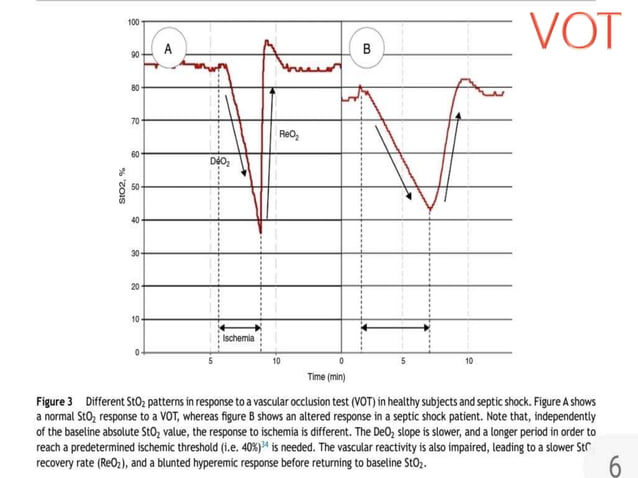 Microcirculation Vs Macrocirculation