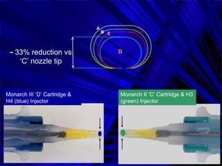 Microcoaxial surgery | PPT