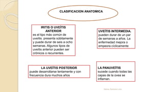 Endoftalmitis, Conjuntuvitis, Uveitis, Coriorretinitis. | PPTX