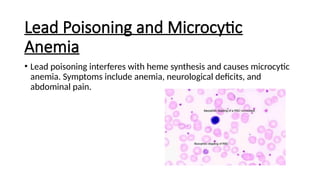 Microcytic Anemias and Its Types.pptx