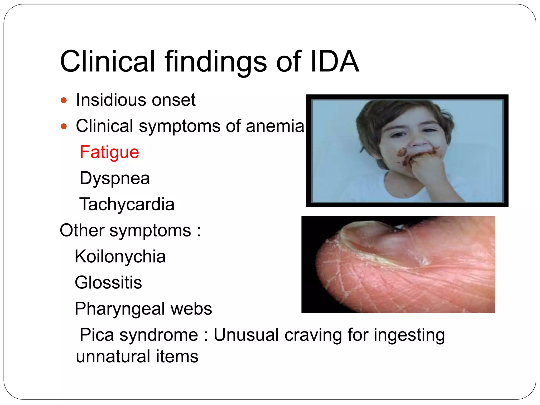 Microcytic hypochromic anemia | PPTX