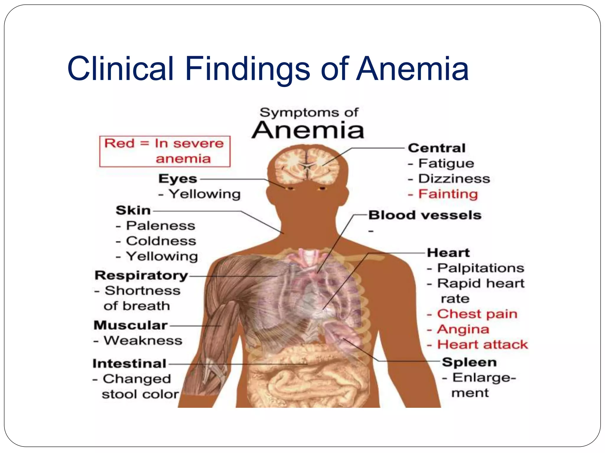 Microcytic hypochromic anemia | PPTX