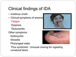 Microcytic hypochromic anemia | PPTX