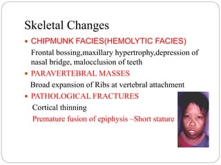Microcytic hypochromic anemia | PPTX