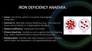 .Microcytic Hypochromic Anemia pathology | PPTX