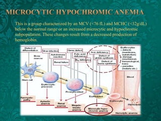 Microcytic hypochromic anemia | PPTX