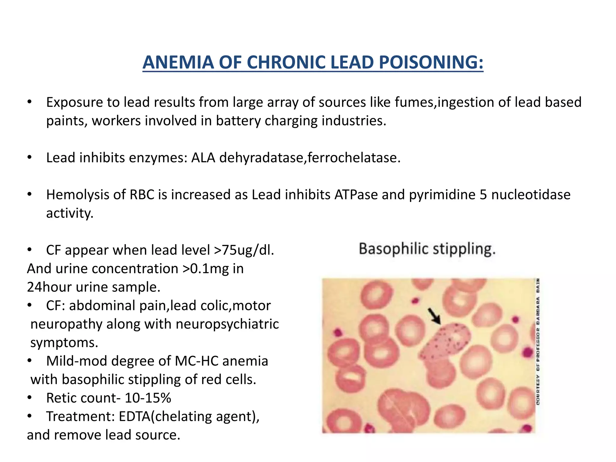 Microcytic hypochromic anemia | PPTX