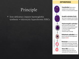 Microcytic hypochromic_Iron_Deficiency_Anaemia.pptx