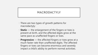 Microdactyly, macrodactyly and hemangioma.ppt