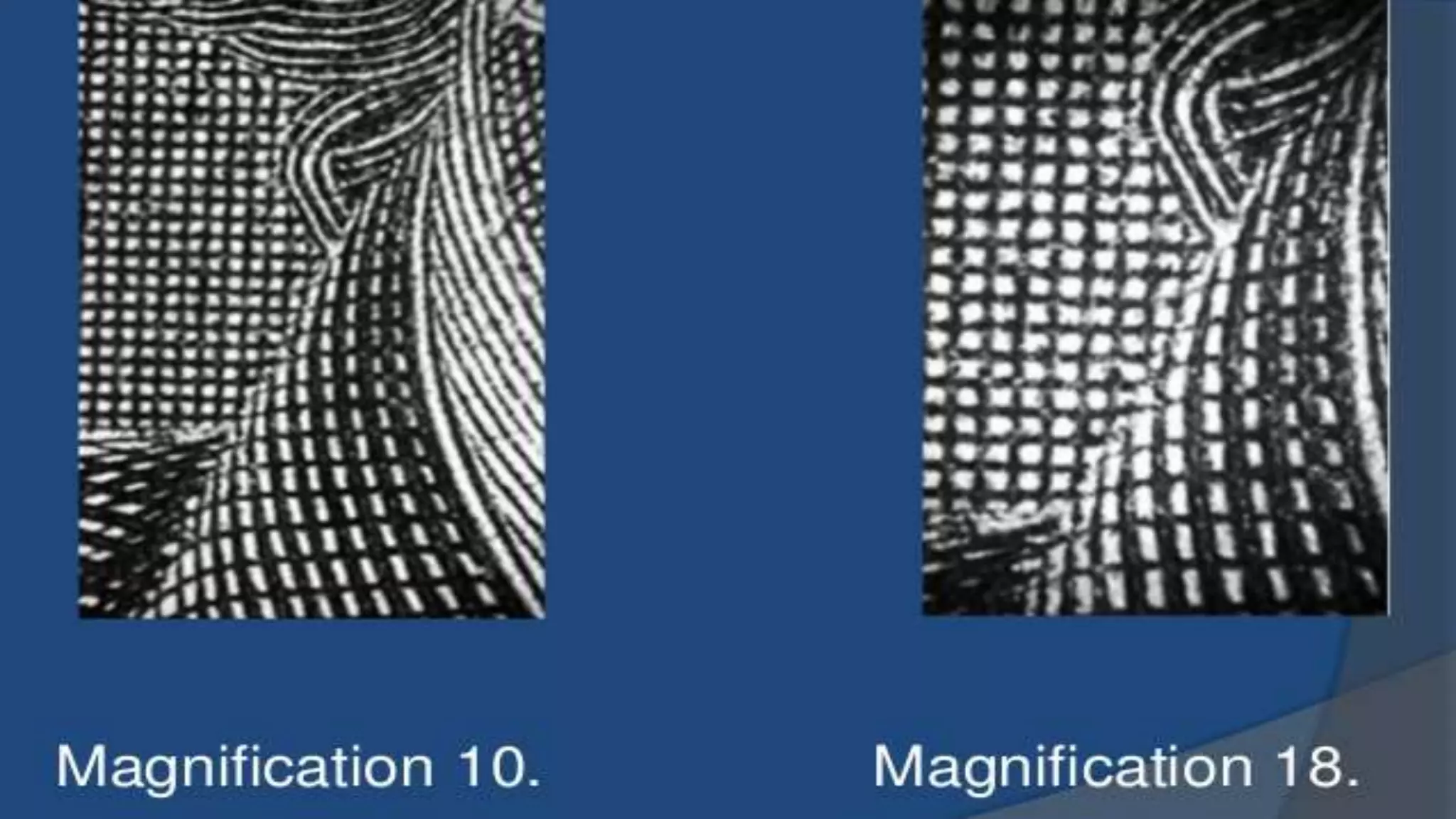 Microdentistry | PPTX