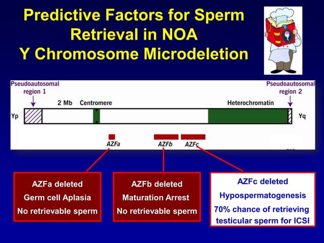 Microdissection testicular sperm extraction | PPTX