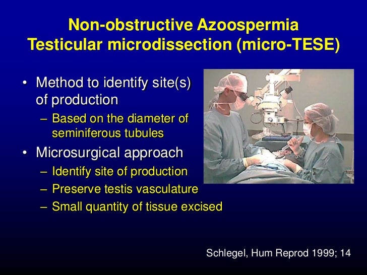 Microdissection Testicular Sperm Extraction