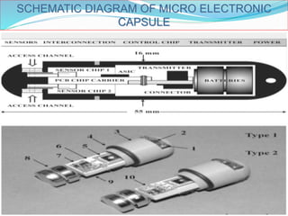 Microelectronics pill | PPTX | Digestive Disorders | Diseases and ...