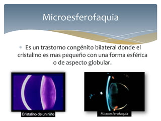 Microesferofaquia | PPTX