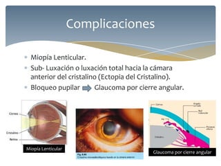 Microesferofaquia | PPTX