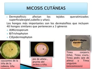 Morfología microscópica y macroscópica de los hongos | PPTX