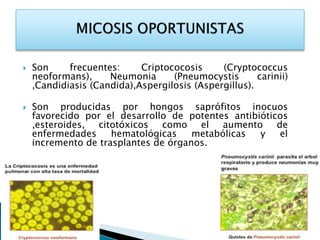 Morfología microscópica y macroscópica de los hongos | PPTX