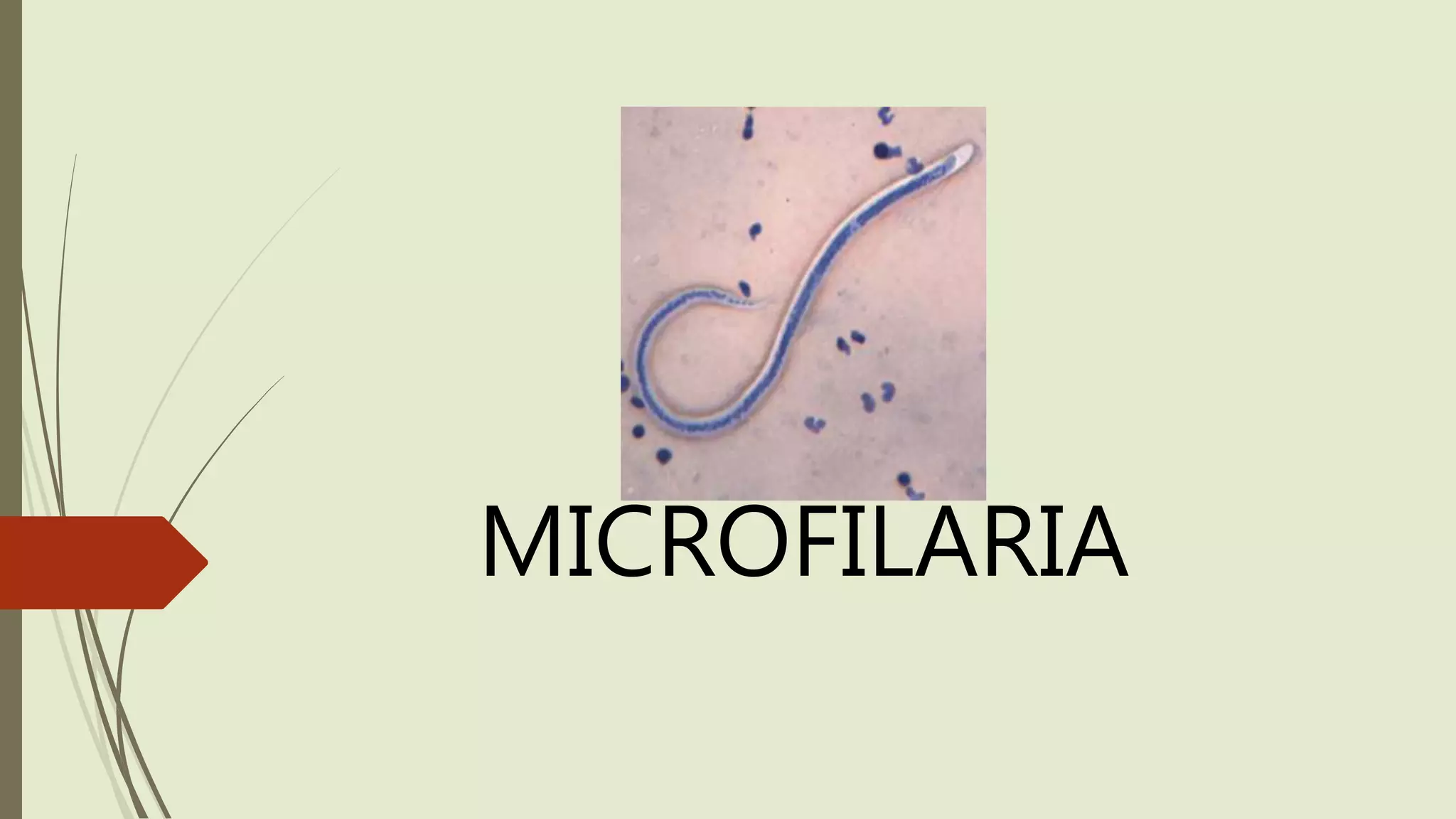 Microfilariae (Wuchereria Bancrofti) | PPTX