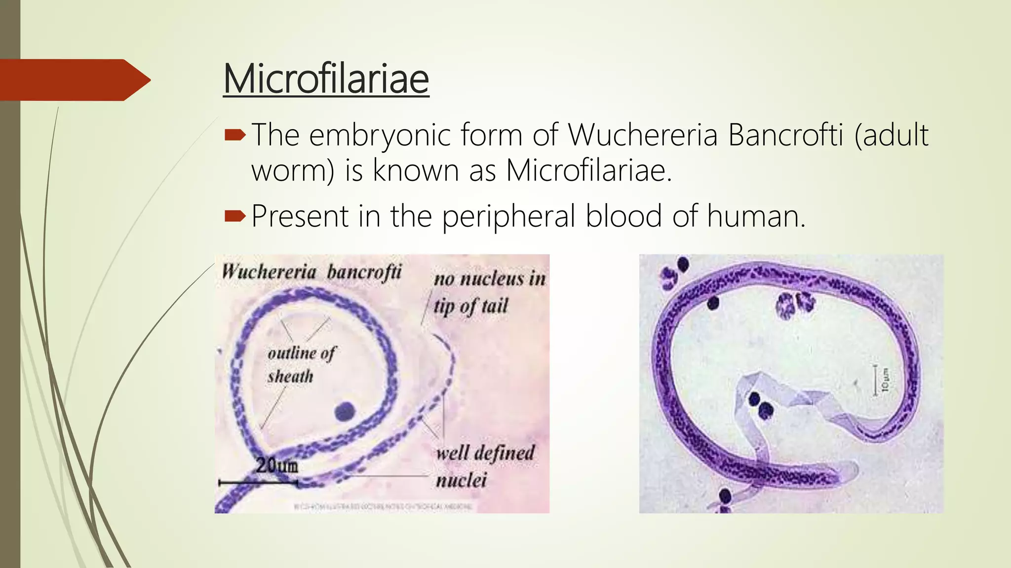 Microfilariae (Wuchereria Bancrofti) | PPTX