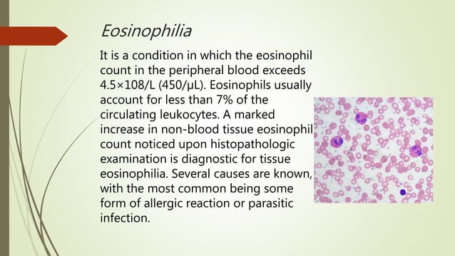 Microfilariae (Wuchereria Bancrofti) | PPTX