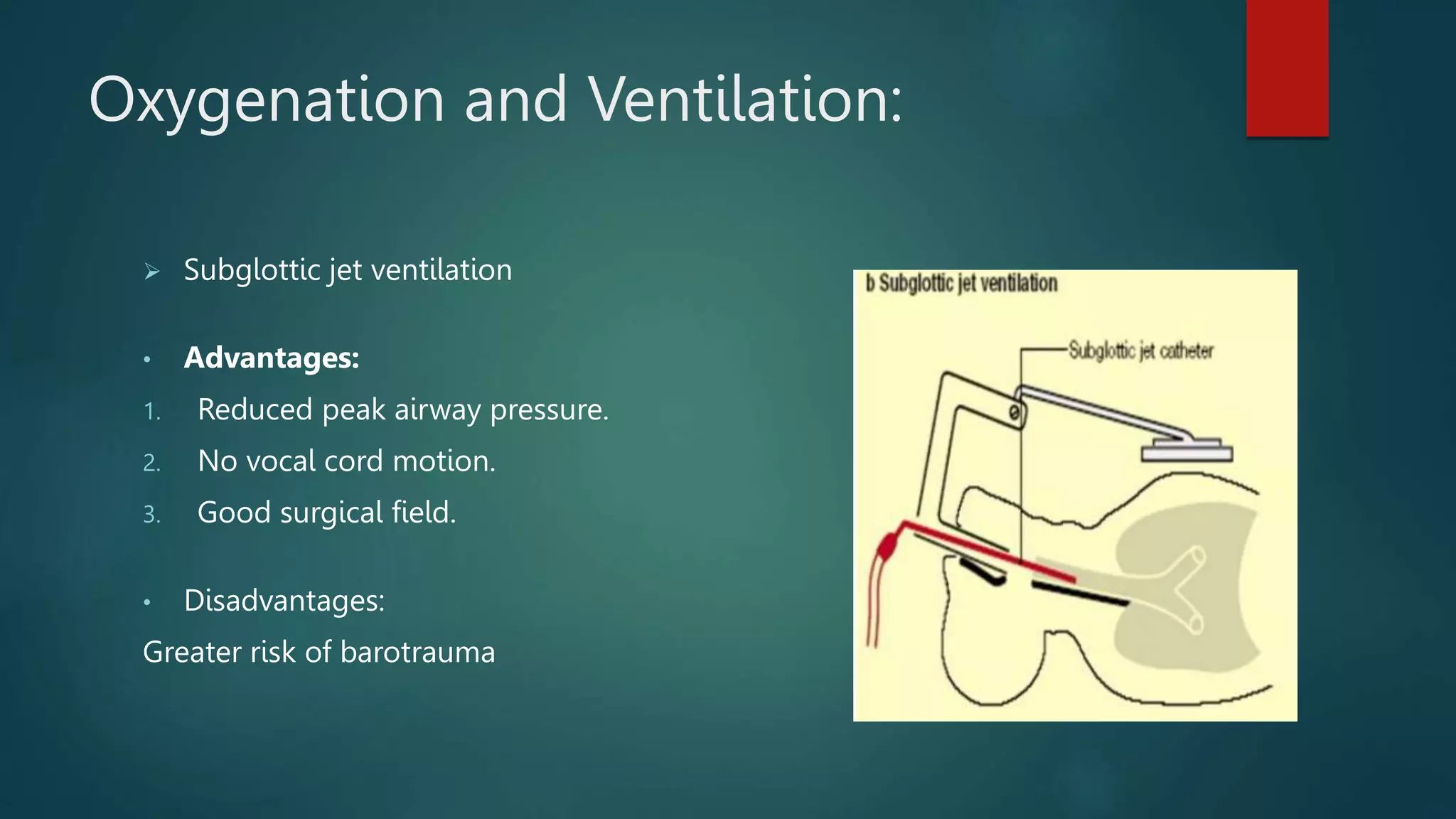 Microlaryngeal surgery.pptx