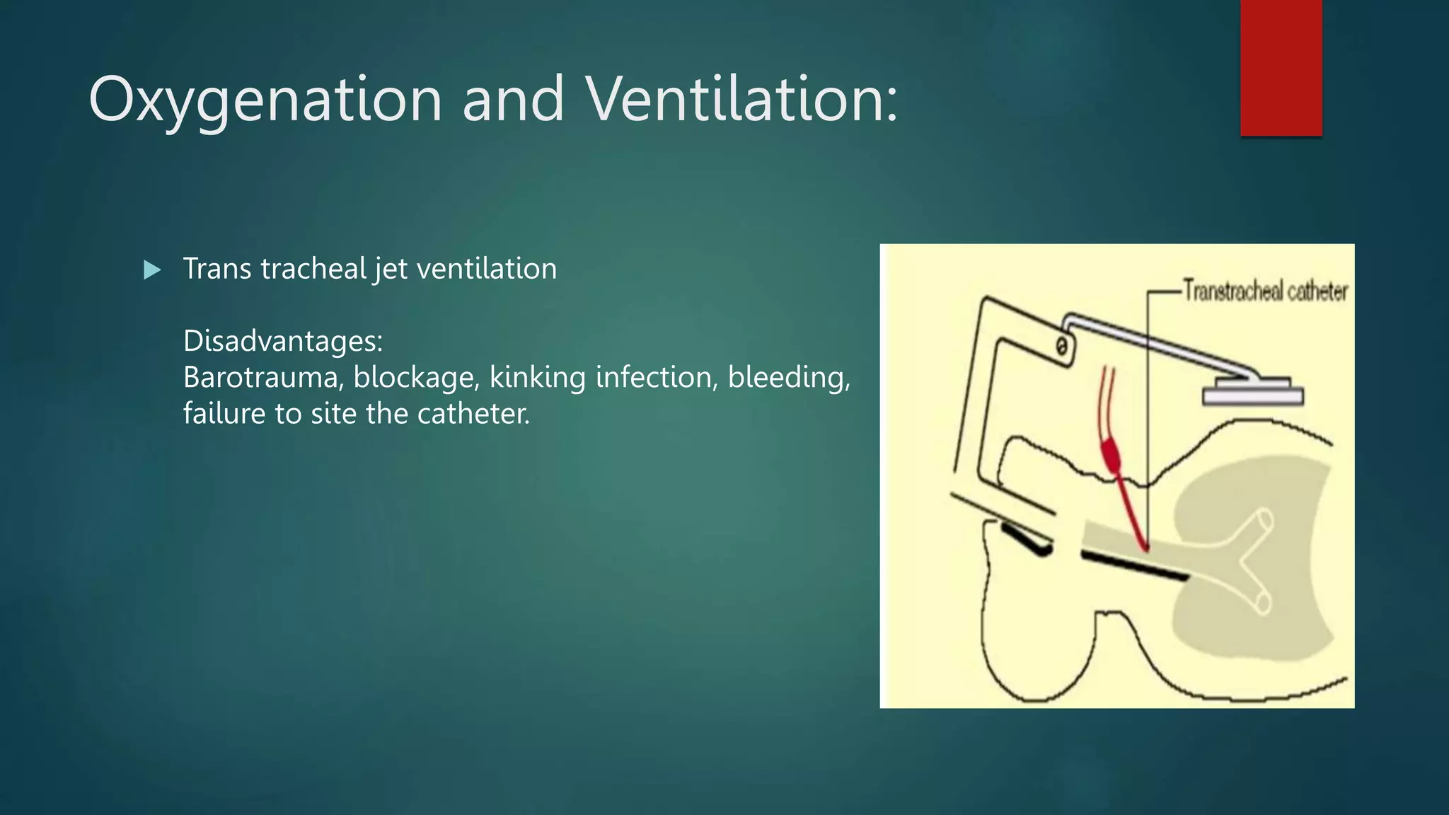 Microlaryngeal surgery.pptx