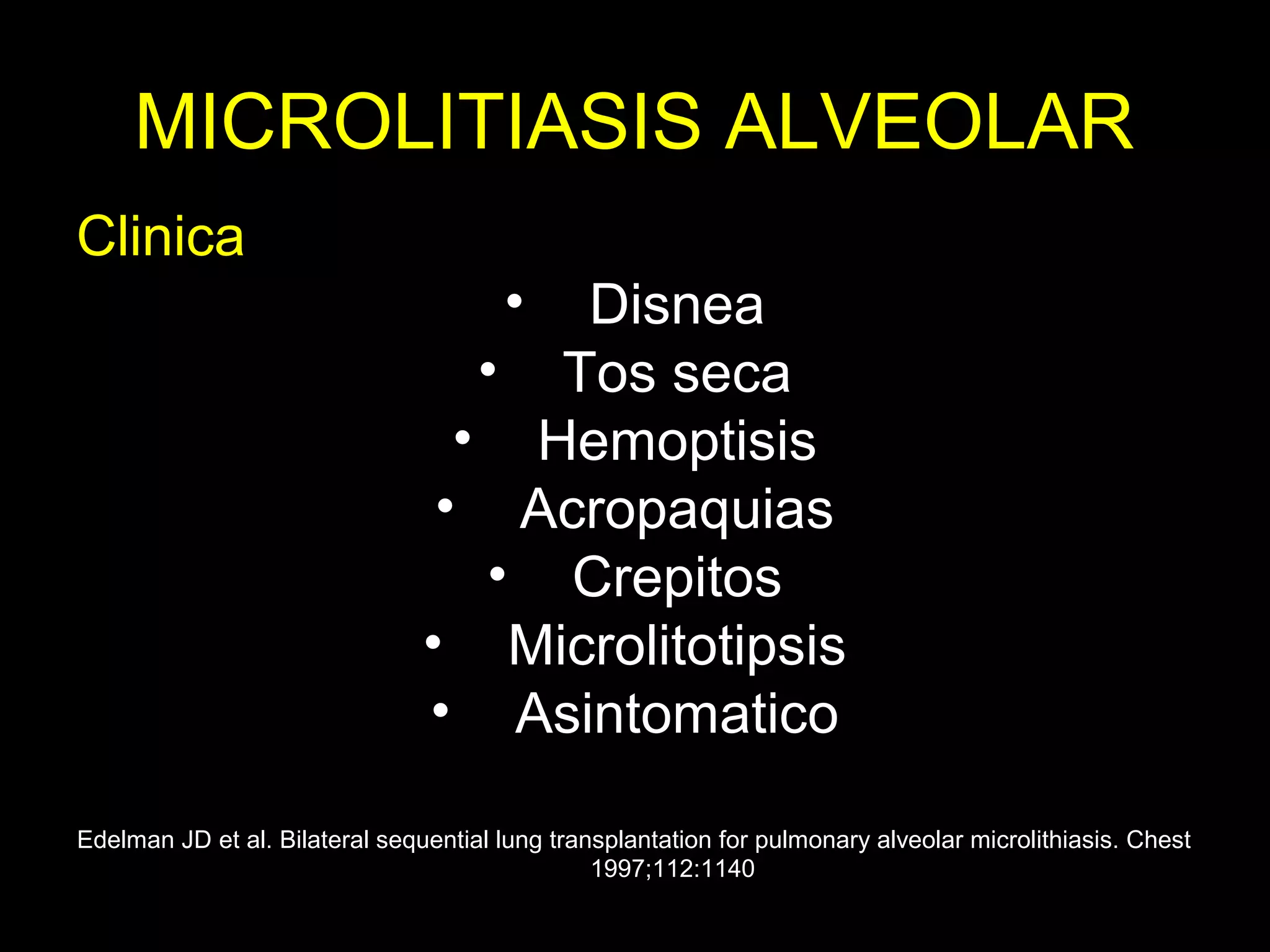 Microlitiasis alveolar | PPT