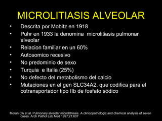 Microlitiasis alveolar | PPT