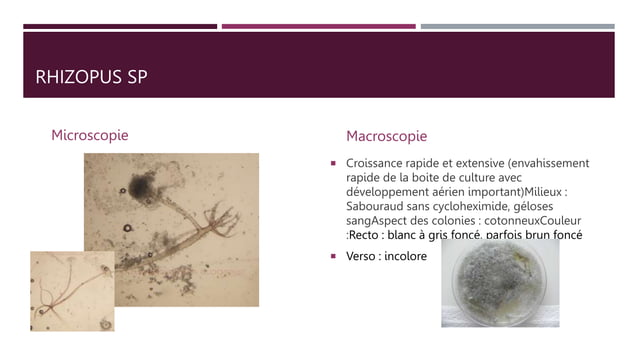 Microscopie et Macroscopie mycosique.pptx