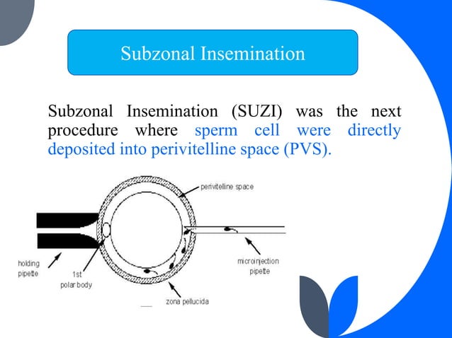 Micromanipulation.pptx