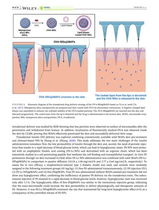 Microneedle-assisted transdermal delivery of nanoparticles.pdf