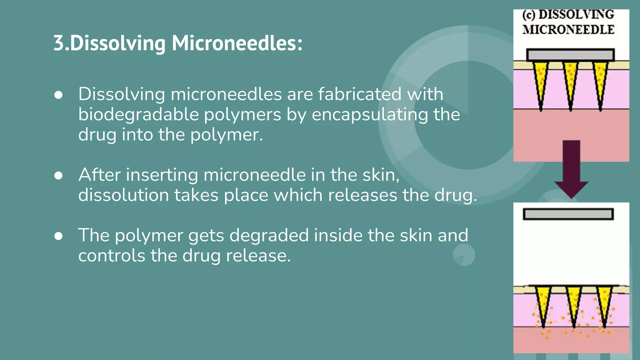 Microneedle a smart approch for transdermal drug delivery system | PPTX