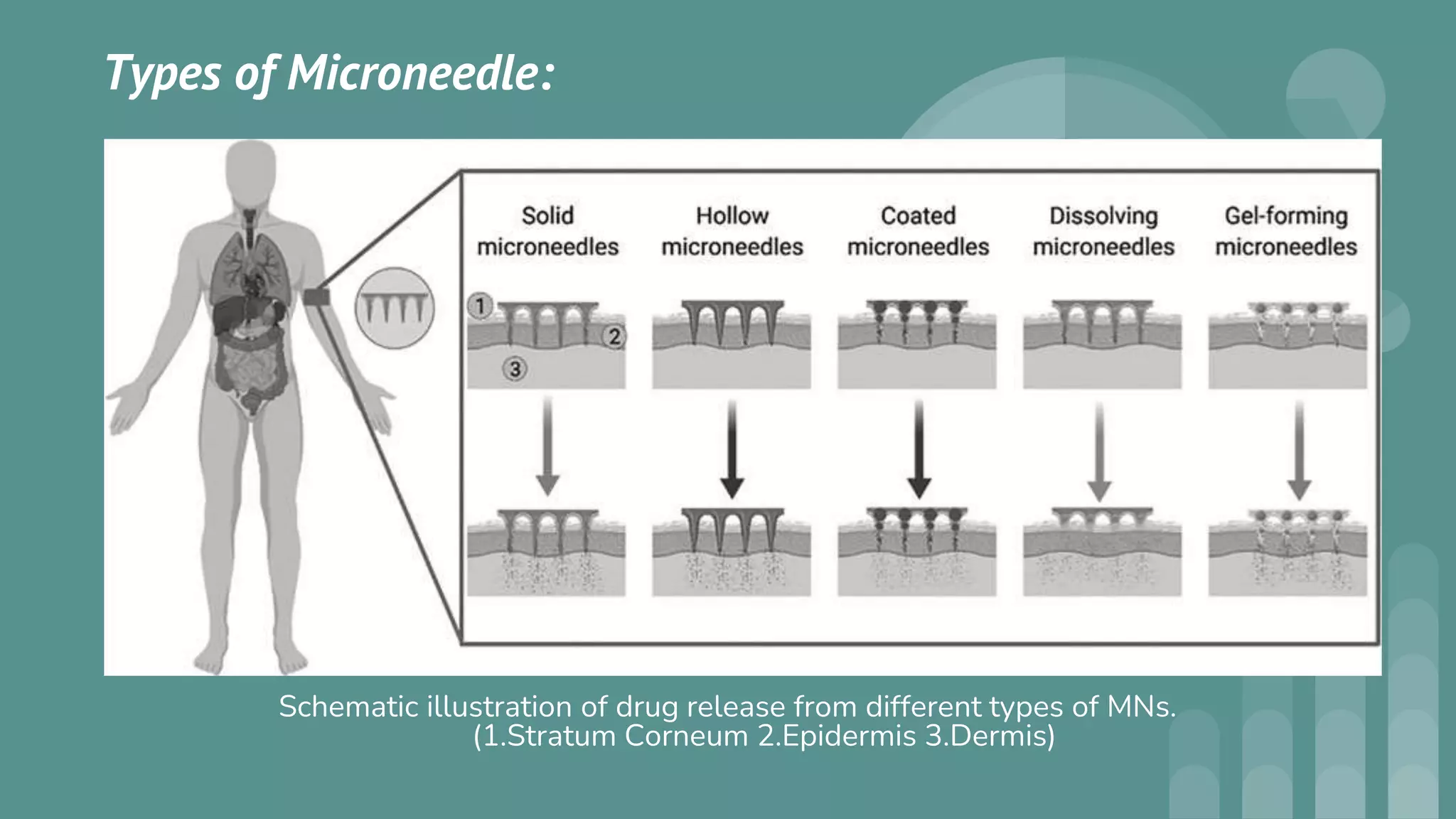 Microneedle a smart approch for transdermal drug delivery system | PPTX