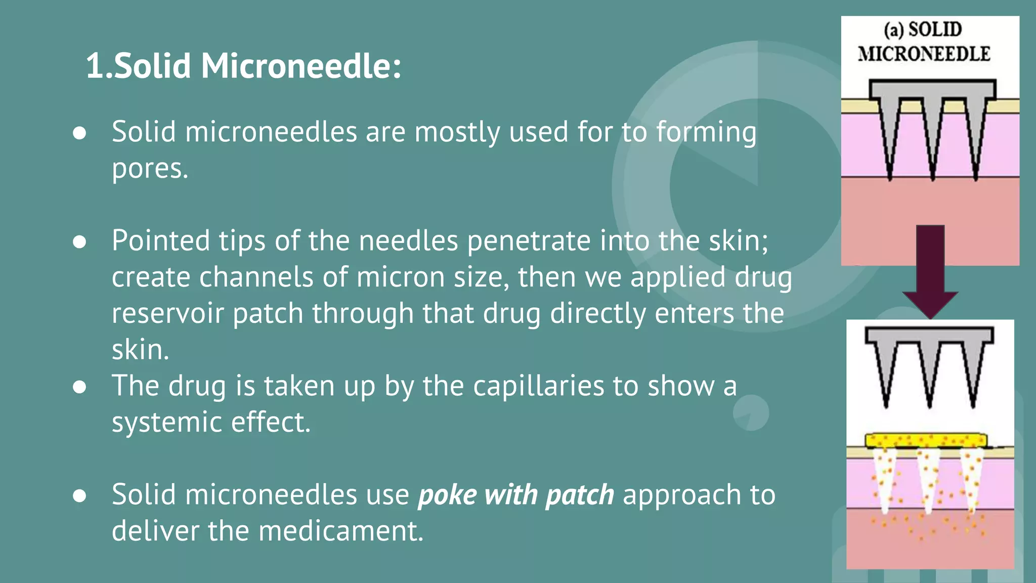 Microneedle a smart approch for transdermal drug delivery system | PPTX