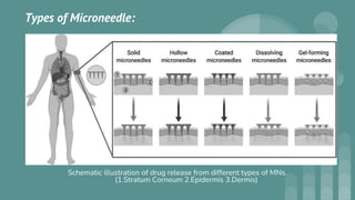 Microneedle a smart approch for transdermal drug delivery system | PPTX
