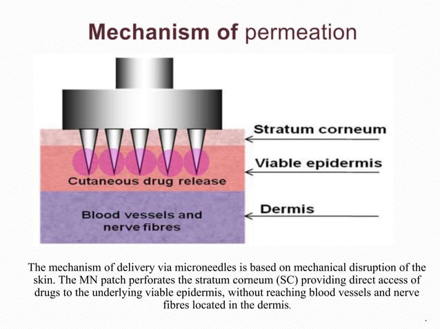 Microneedle in Transdermal drug delivery system | PPTX | First Aid ...