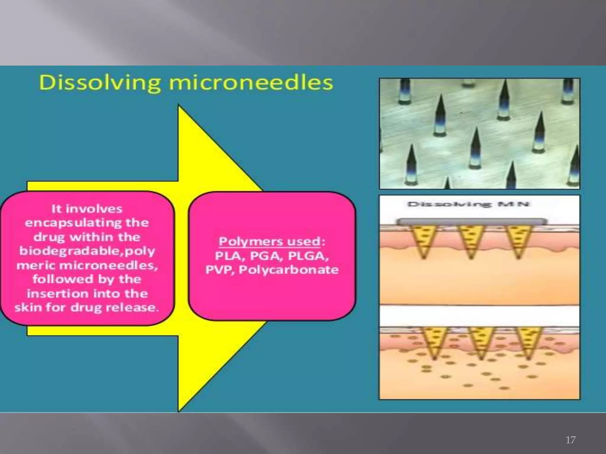 MICRONEEDLE: AN APPROACH FOR DRUG PERMEATION THROUGH TRANSDERMAL SYSTEM ...