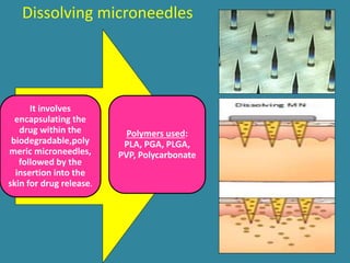 Microneedles in transdermal drug delivery | PPTX