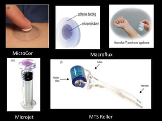 Microneedles in transdermal drug delivery | PPTX