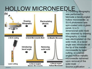 Microneedles in Transdermal Drug Delivery System | PPTX
