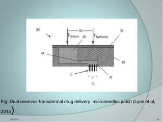 Microneedles in Transdermal Drug Delivery System | PPTX