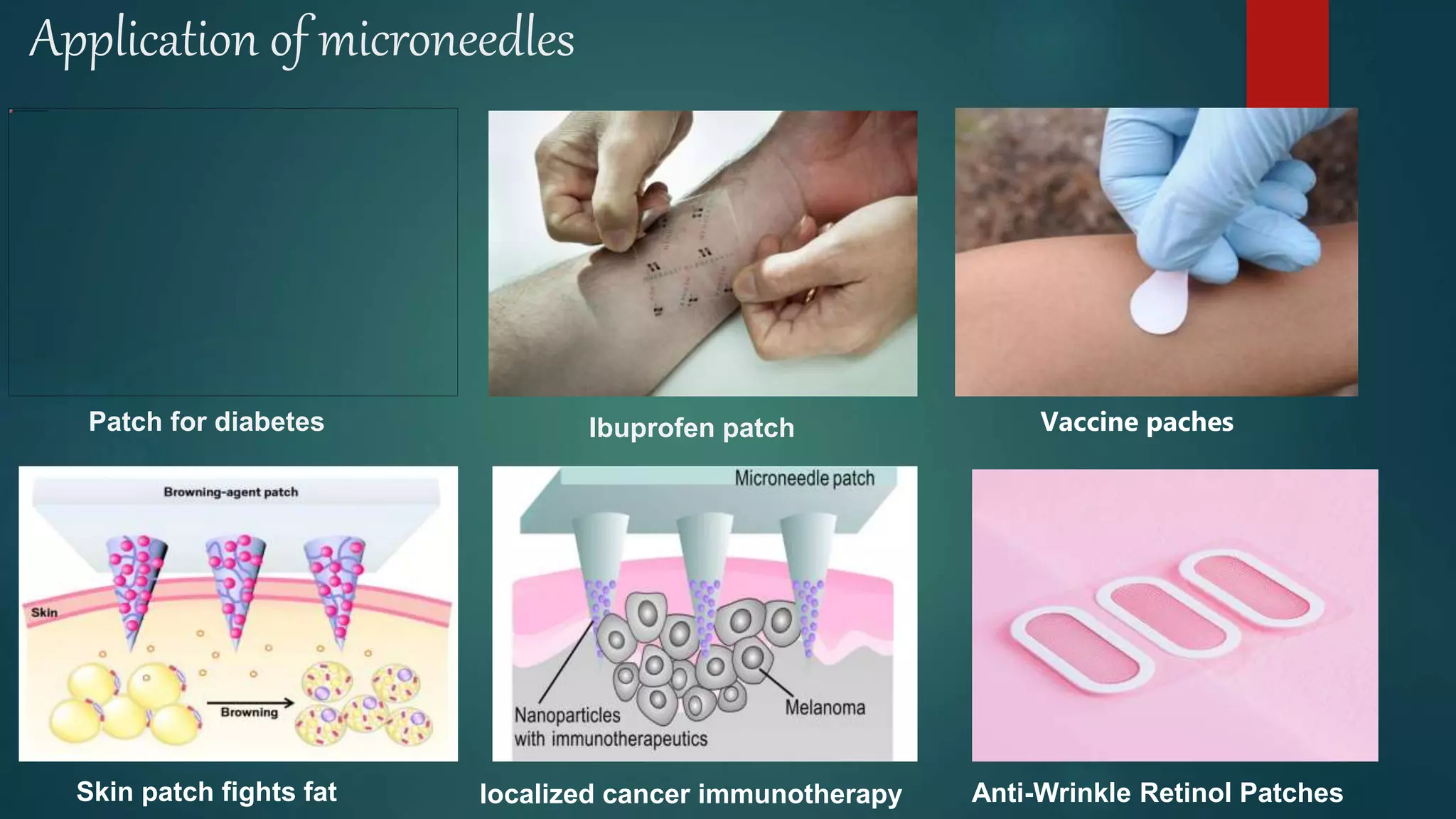 Microneedles | PPTX