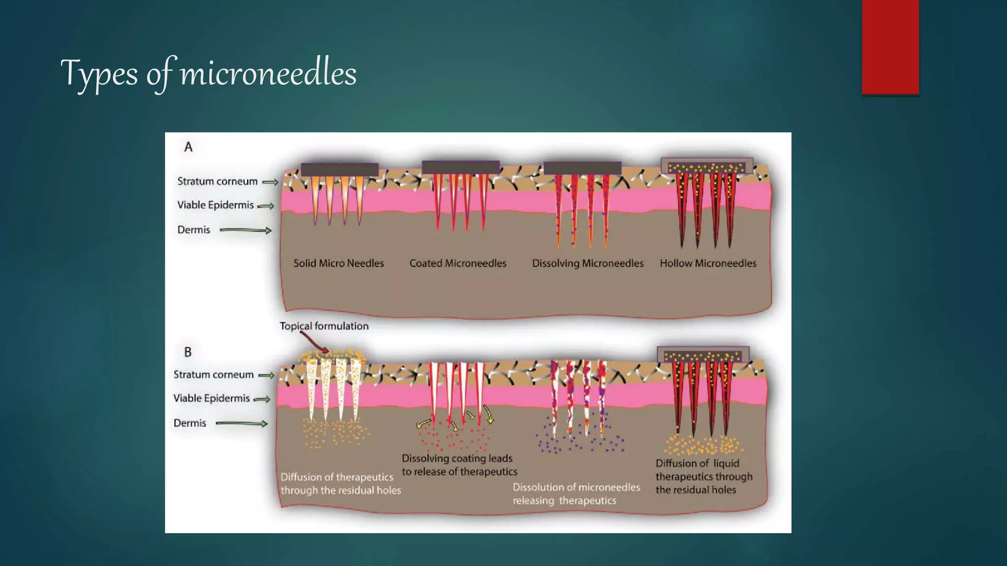 Microneedles | PPTX