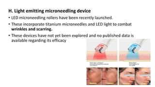 Microneedling a basic overview in derma.pptx